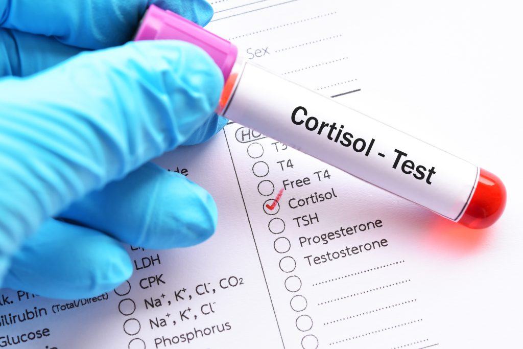 Cushing Syndrome - Health Beat
